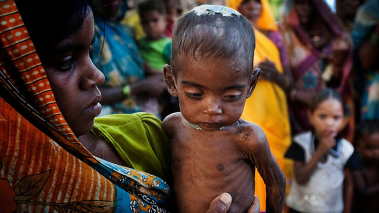 Suposhit Odisha Mission Launched to Combat Child Malnutrition